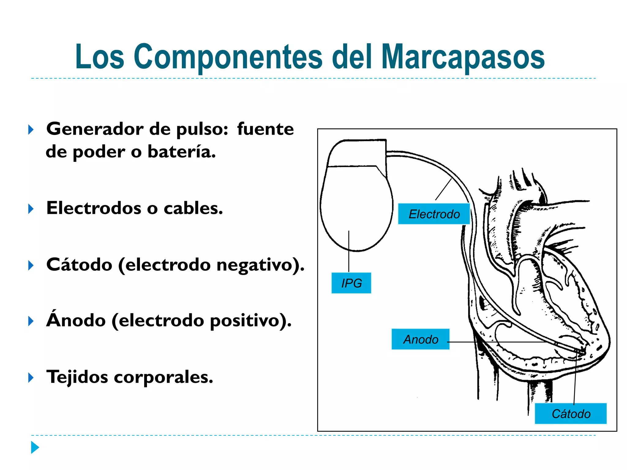 Manejo perioperatorio del paciente con marcapasos | PDF