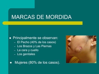 MARCAS DE MORDIDA | PPTX