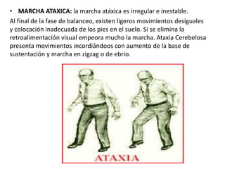 Marcha Atáxica