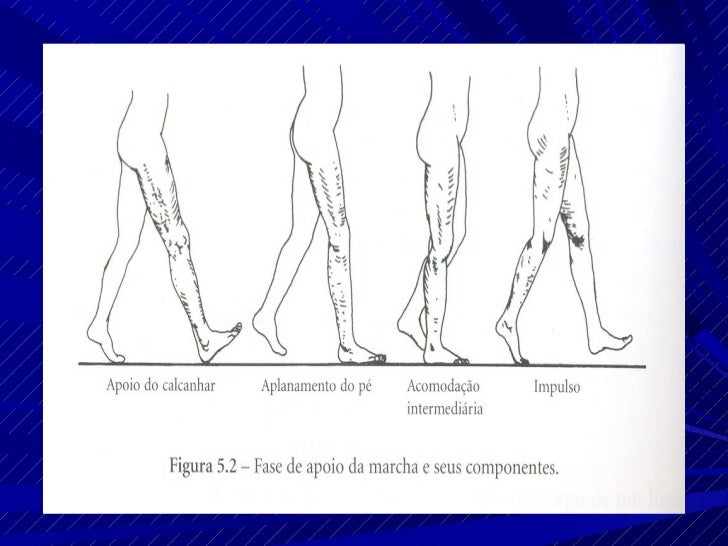 Marcha normal e_patologica