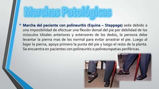 Marchas, facies y movimientos patológicos | PPTX