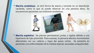 Marchas, facies y movimientos patológicos | PPTX