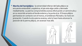 Marchas, facies y movimientos patológicos | PPTX