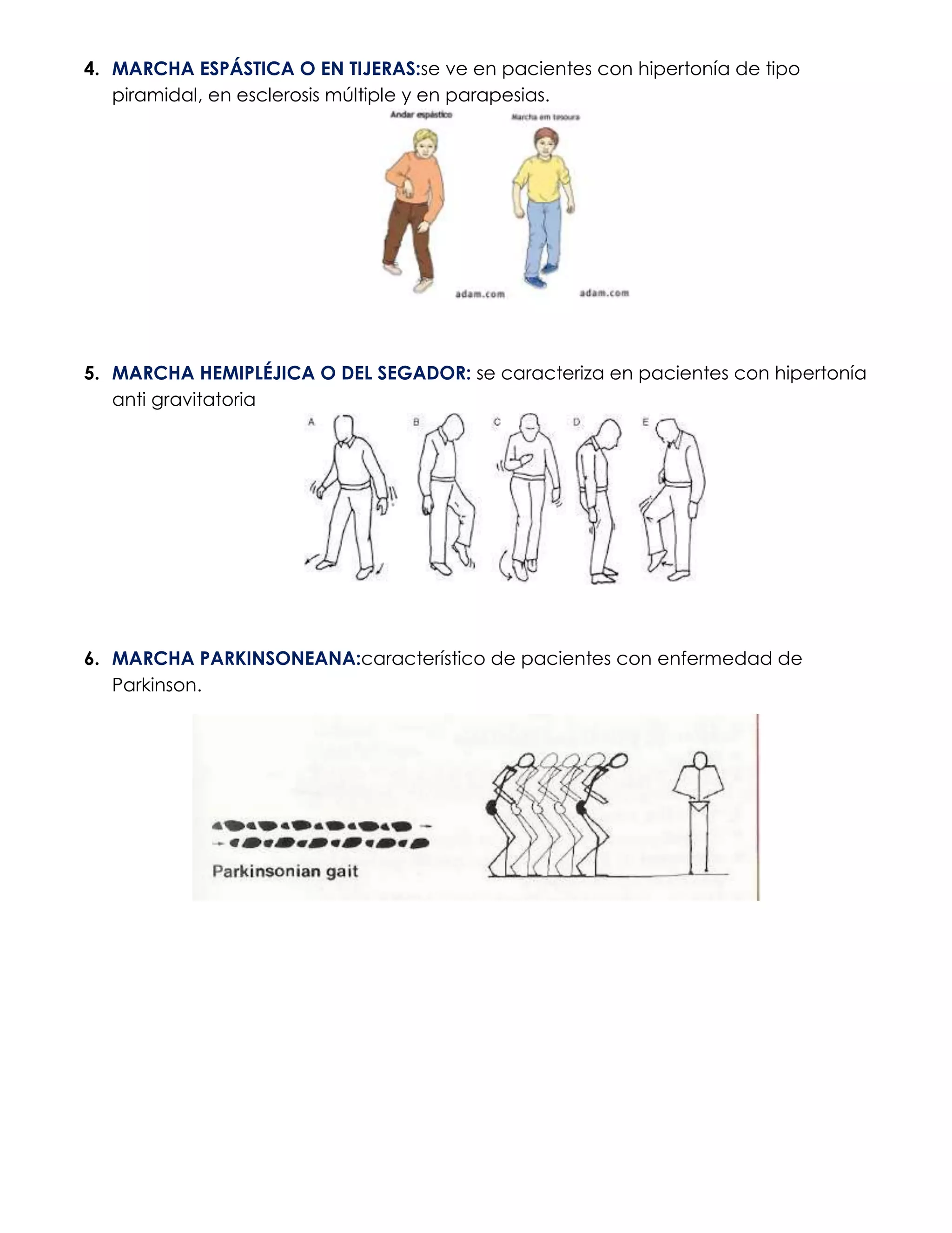 Marchas patologicas y sus patrones | DOCX