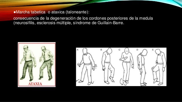 Marcha y su reducacion