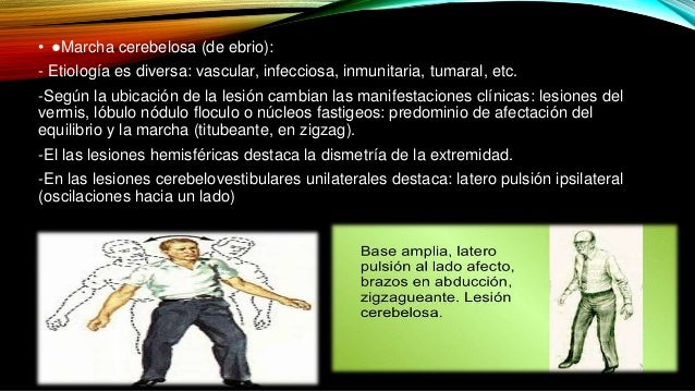 Marcha y su reeducacion