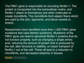 Marfan syndrome | PPTX