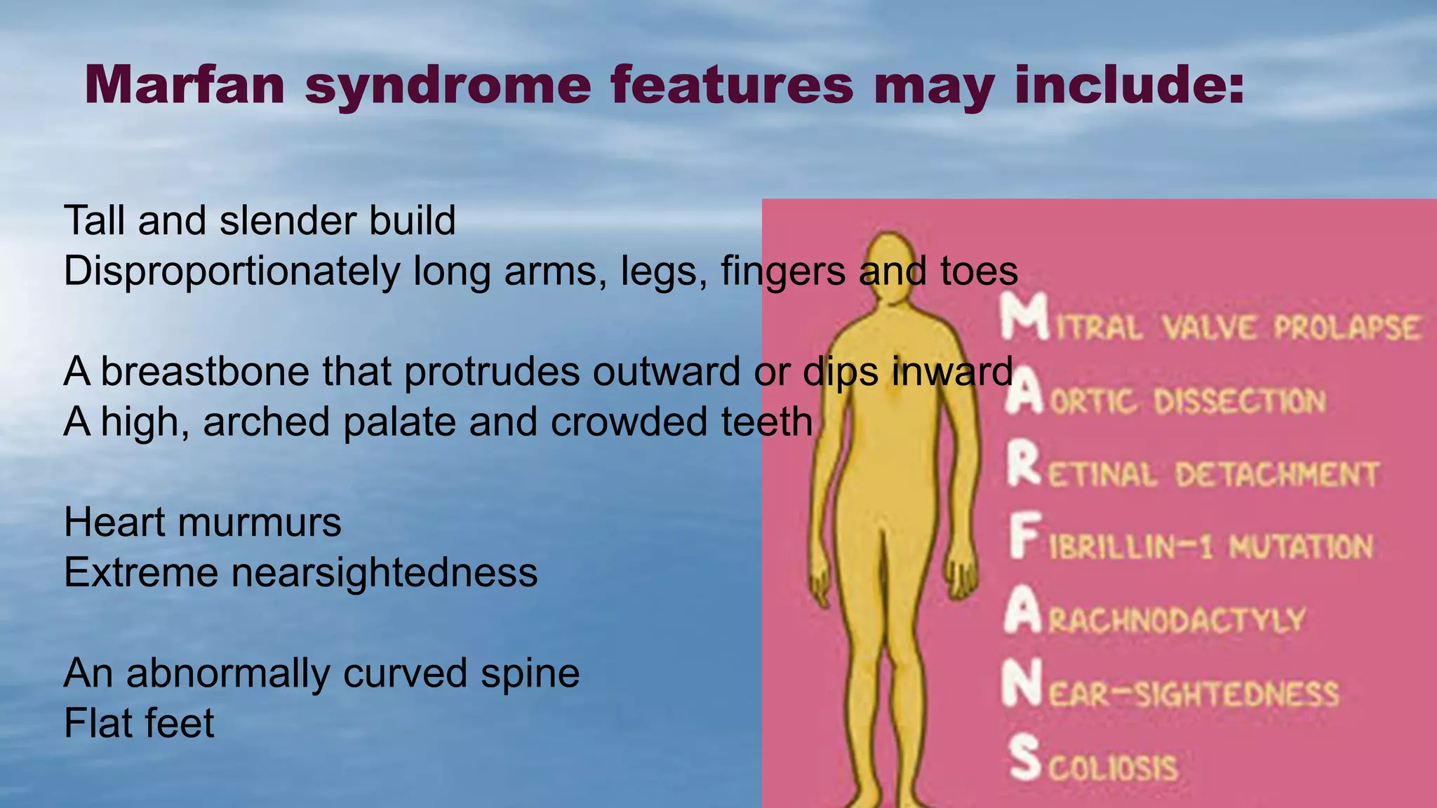 Marfan syndrome - a detailed study ( all medical information ) | PPTX