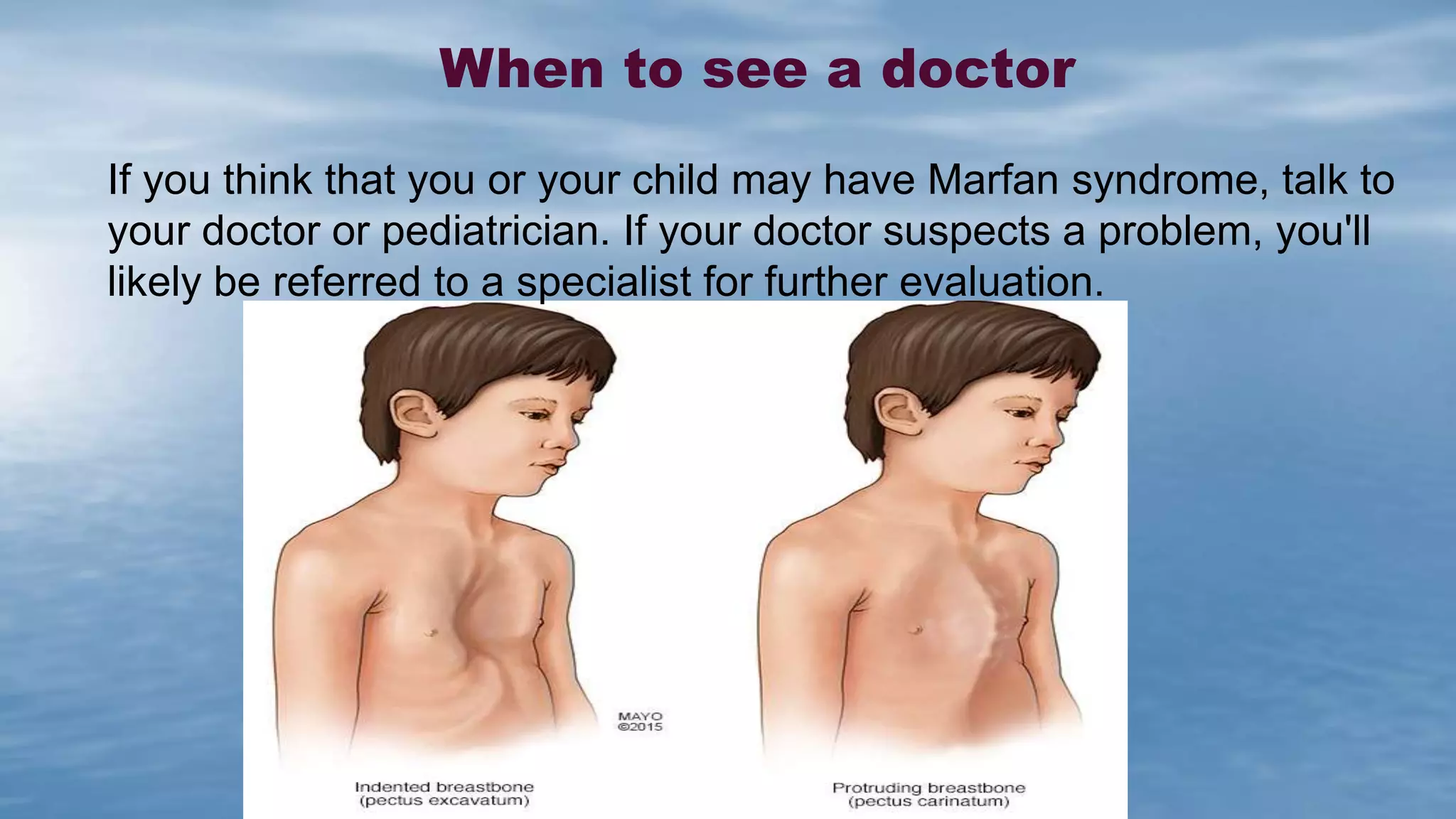 Marfan syndrome - a detailed study ( all medical information ) | PPTX