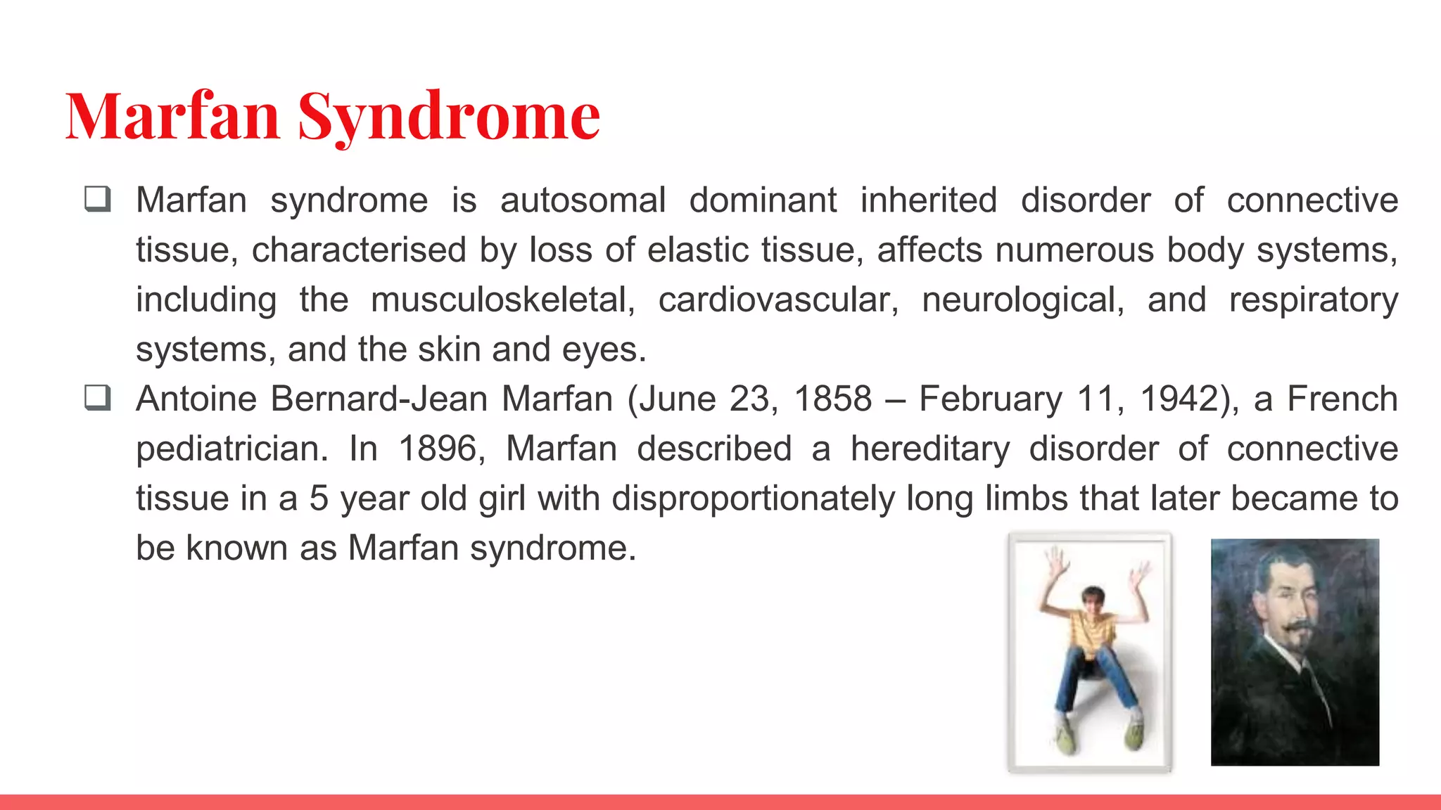 Marfan syndrome | PPTX