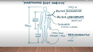 Marfanoid Habitus