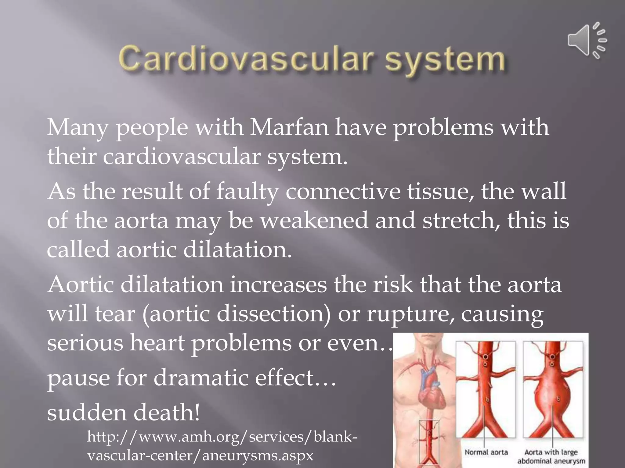 Marfan syndrome andrew | PPTX