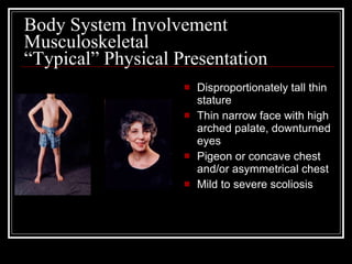 Marfan Syndrome and the School Nurse | PPT