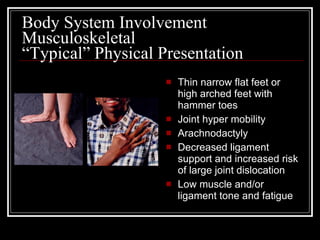 Marfan Syndrome and the School Nurse | PPT
