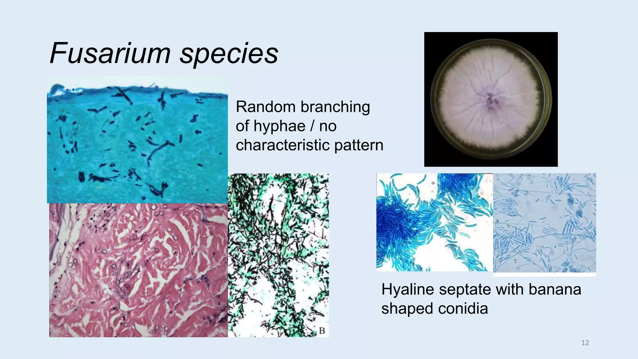 Fungal Pathology in Tissue | PPTX