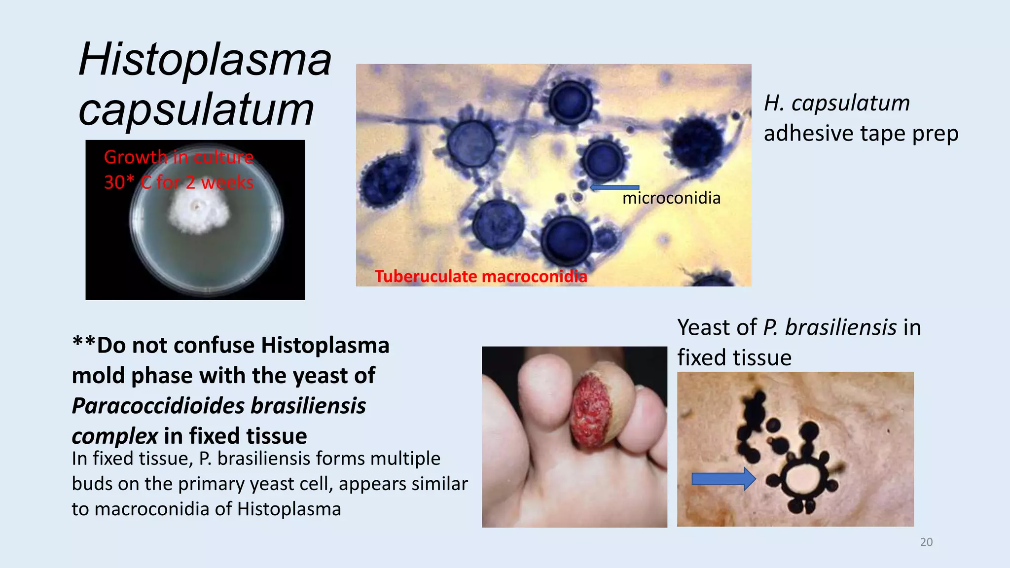 Fungal Pathology in Tissue | PPTX