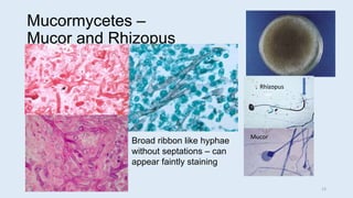 Fungal Pathology in Tissue | PPTX