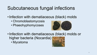 Fungal Pathology in Tissue | PPTX