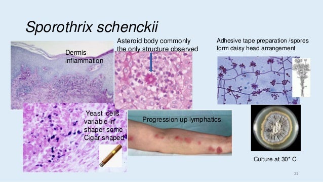 Fungal Pathology in Tissue