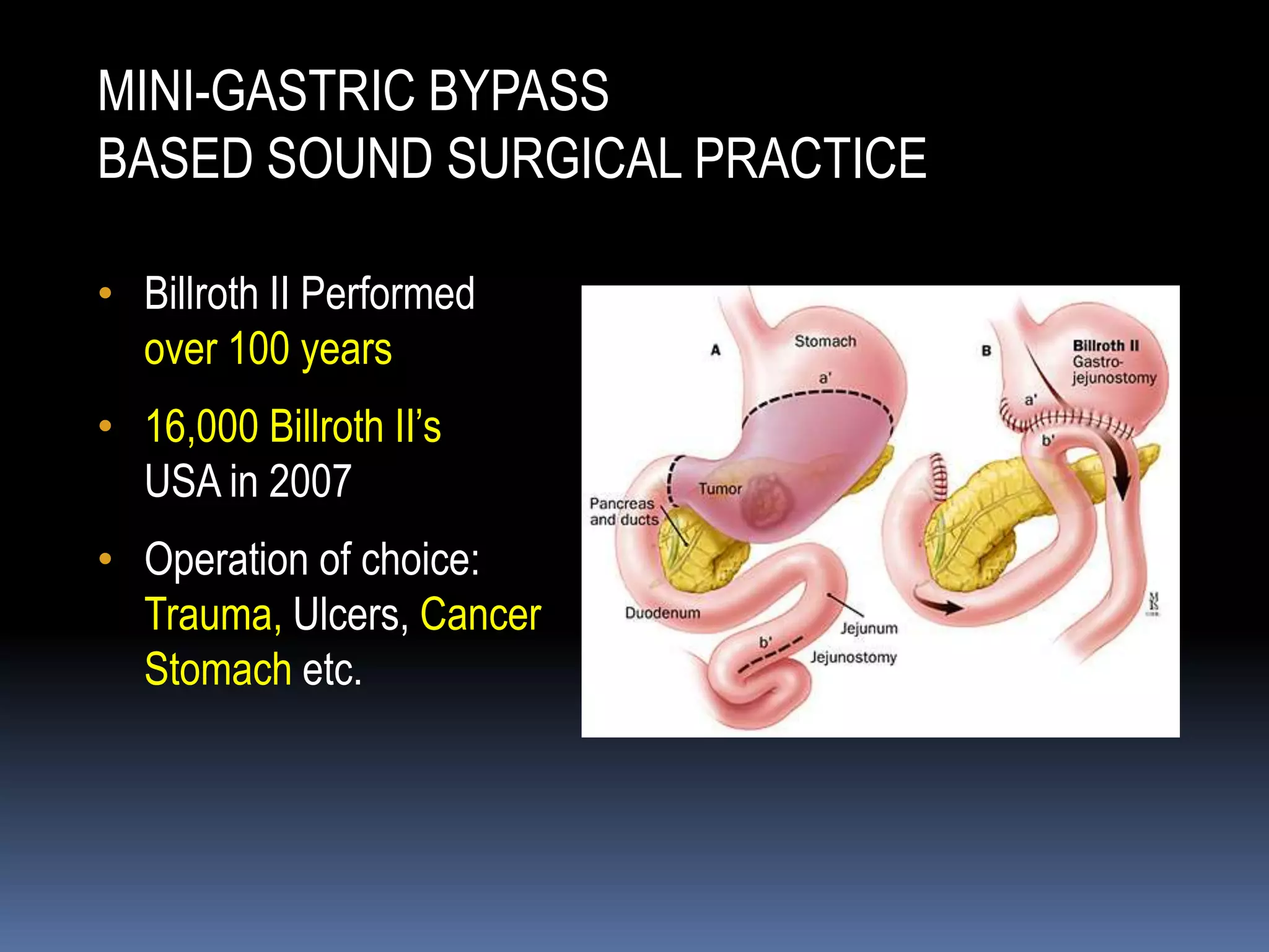 Marginal ulcer gastric bypass | PPTX