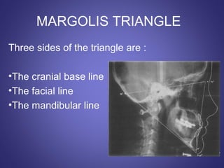 Margolis analysis | PPT