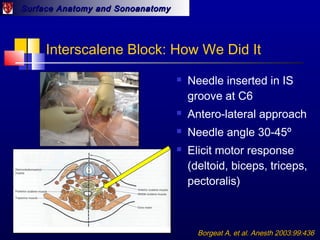 Surface anatomy and sonoanatomy for the occasional regional ...