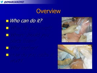 Update on continuous peripheral nerve block techniques | PPTX