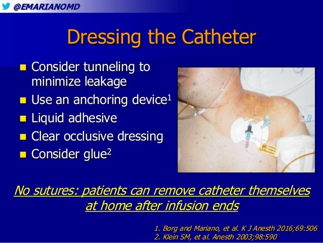 Update on continuous peripheral nerve block techniques