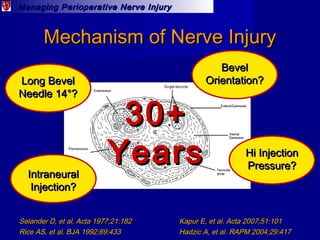 Management of the patient with suspected perioperative nerve injury | PPT
