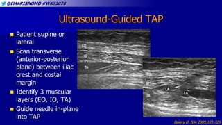 Interfascial Plane Blocks: Should We Believe the Hype? | PPTX
