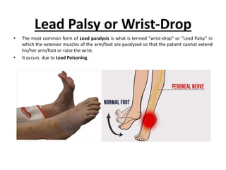 Marine water pollution and diseases | PPT