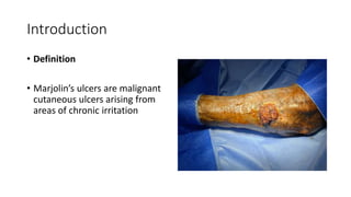 A Power Point Presentation on Marjolin's ulcer.pptx