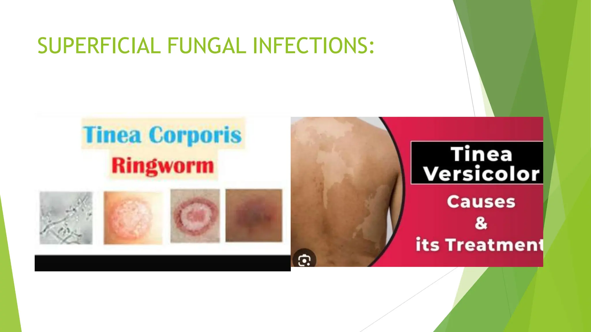 The skin represents the largest organ of the human body.pptx