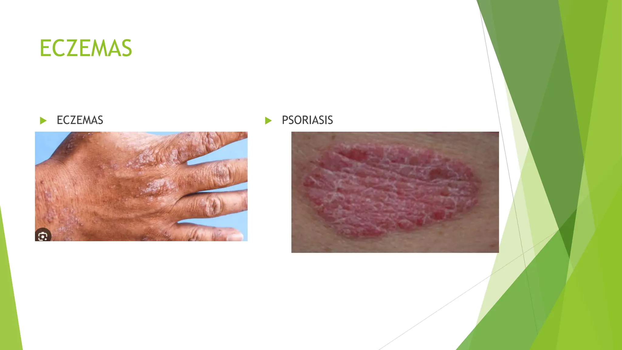 The skin represents the largest organ of the human body.pptx