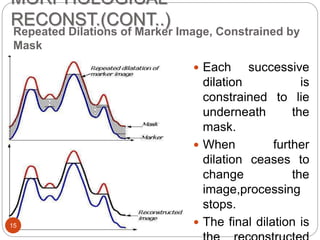 Marker Controlled Segmentation Technique for Medical application | PPT