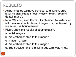 Marker Controlled Segmentation Technique for Medical application | PPT