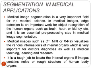 Marker Controlled Segmentation Technique for Medical application | PPT