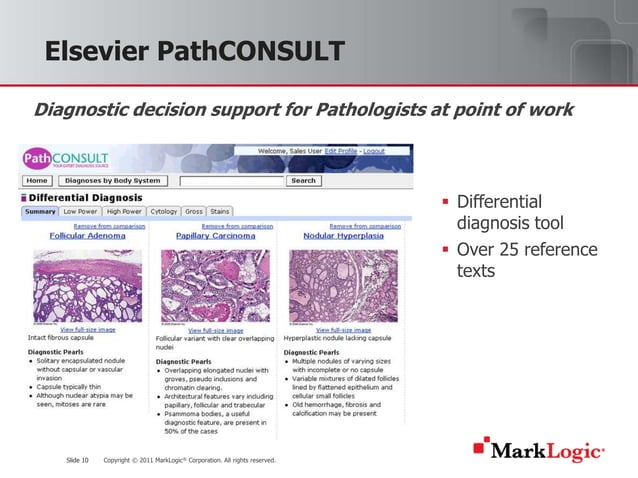 MarkLogic Applications in Healthcare | PPT