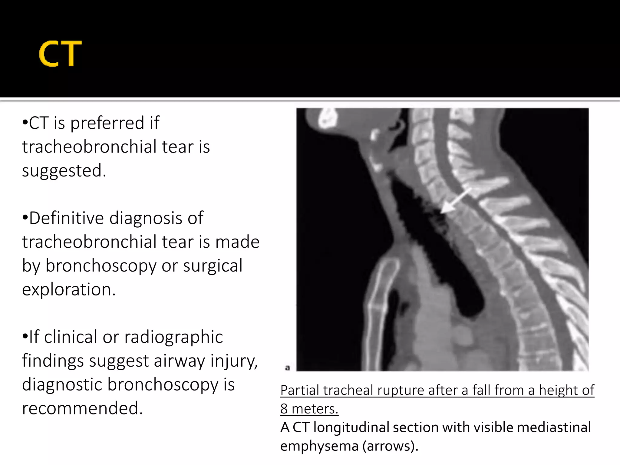 Mark rosemary. diagnosis of traumatic injury of the trachea | PPTX