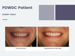 Cosmetic Smile Makeovers: Overview + Examples | PDF