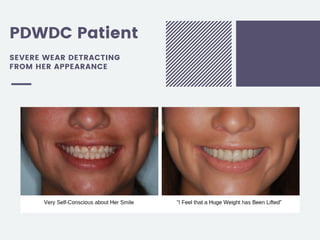Cosmetic Smile Makeovers: Overview + Examples | PDF