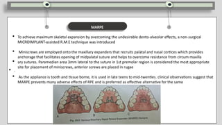 MARPE Orthodontics and dentofacial orthopedic | PPTX