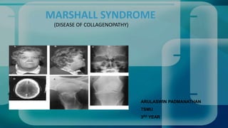 Marshall syndrome | PPT