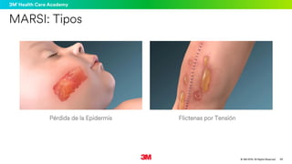 Lesiones De Daño A La Piel Heridas Tipo Marsi Pdf