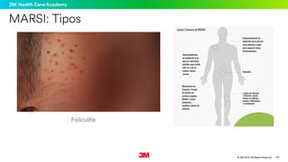 Lesiones de daño a la piel heridas tipo Marsi.pdf