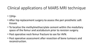 MARS MRI | PPTX