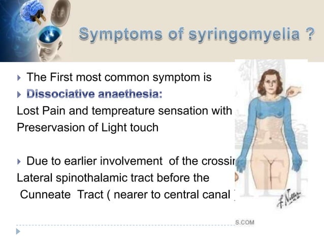 Syringomyelia ( Morvan syndrome) Electrodiagnosis | PPT