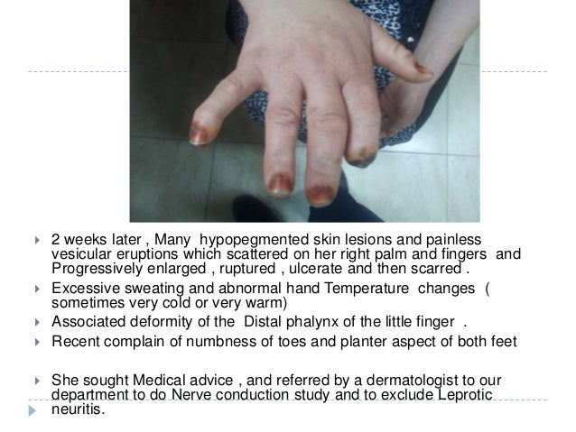 Syringomyelia ( Morvan syndrome) Electrodiagnosis