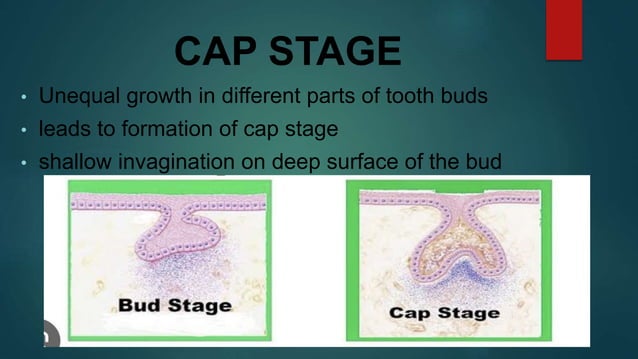 Tooth development cap stage | PPTX | Dental Health | Diseases and ...