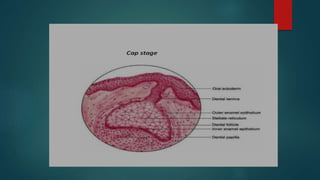 Tooth development cap stage | PPTX
